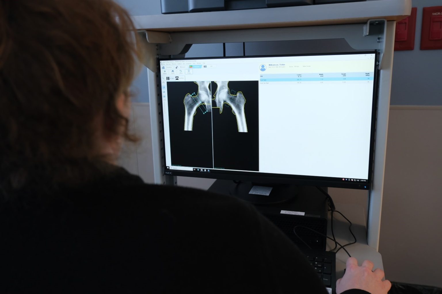 MedRVA Unveils Cutting-Edge DXA Machine for Body Scans